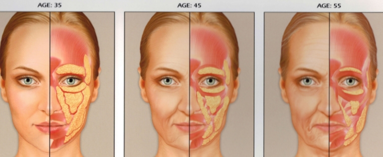 Skin Worries and Concerns - Volume loss and Skin Laxity - Award winning ...